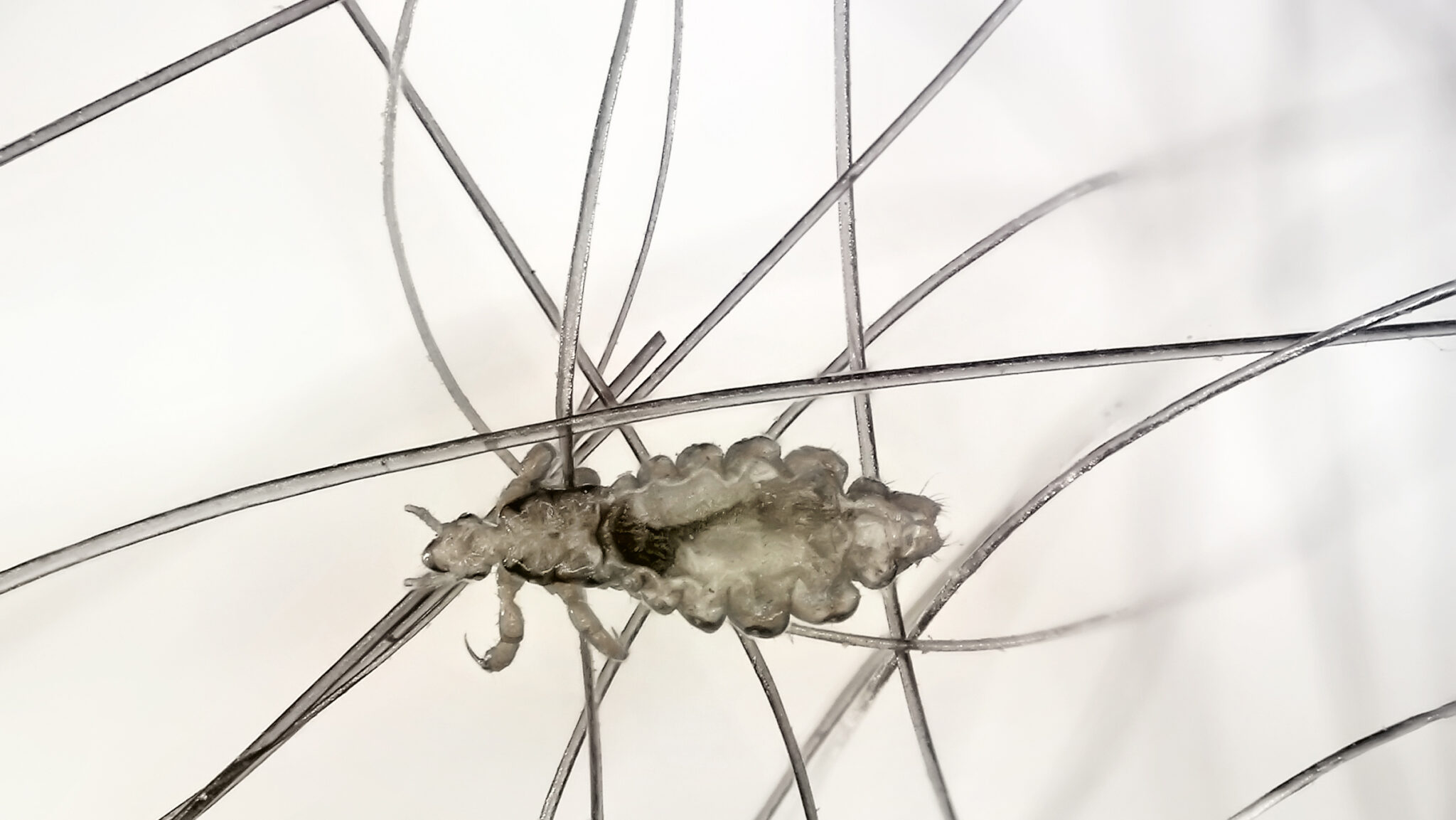 Iarna este perioada de vârf pentru păduchi: Ce trebuie să știe părinții